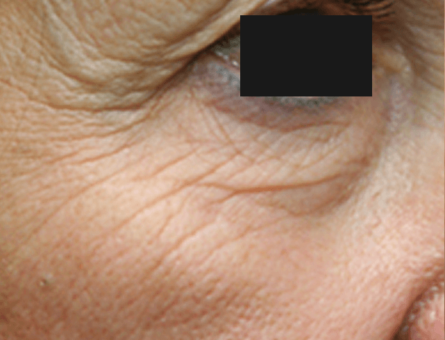 Pelleve Gallery - Dr. Sean Simon